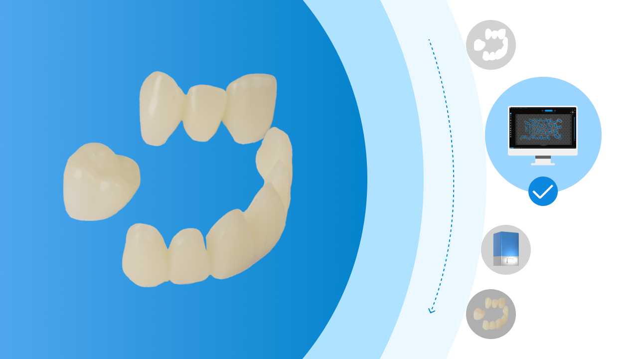 How to Process Temporary Crowns and Bridges before Printing? | CHITUBOX ...